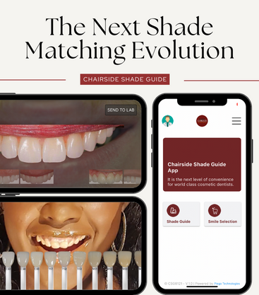 The Next Shade Matching Evolution (1)